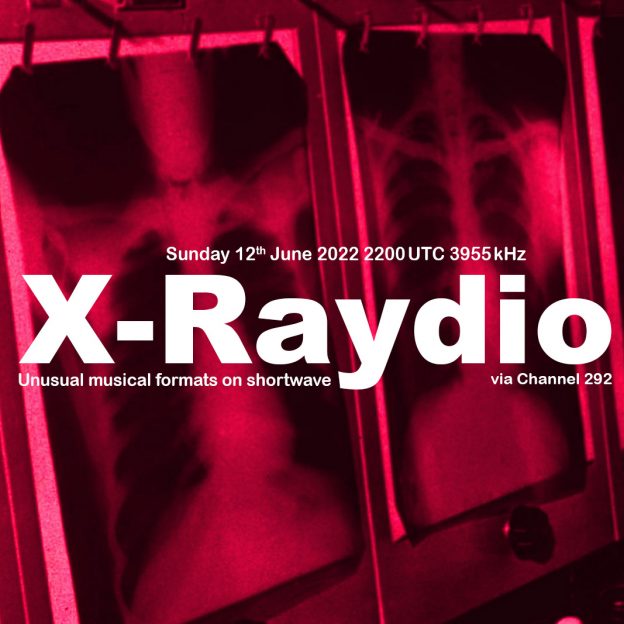 X-Raydio on Channel 292 | The SWLing Post