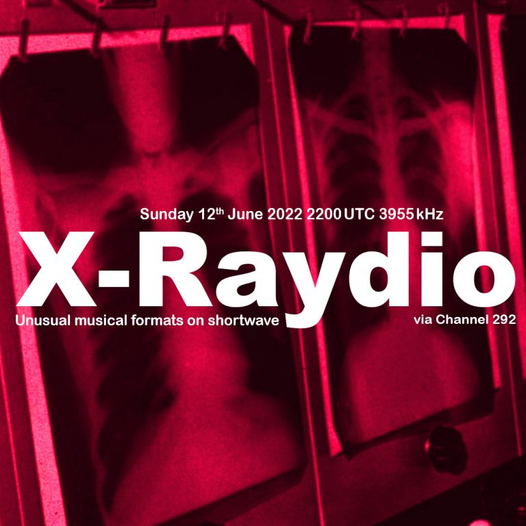 X-Raydio on Channel 292 | The SWLing Post